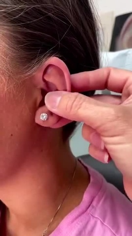 realistic prosthetic ear - Coub